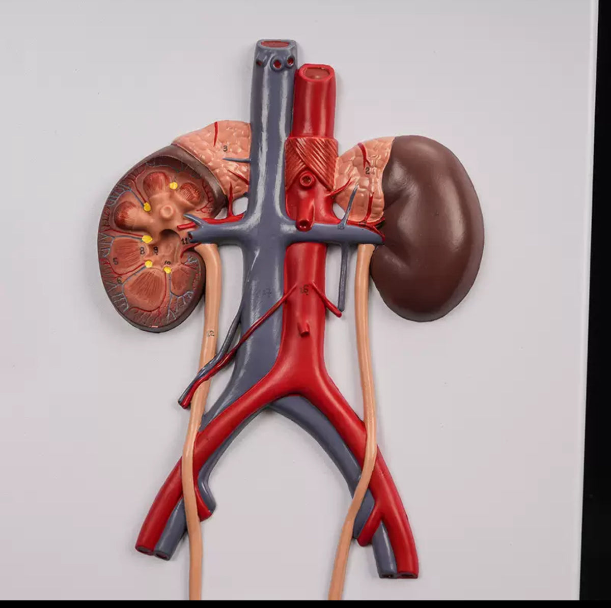 sistema genitourinario masculino y femenino | Coyitosmx